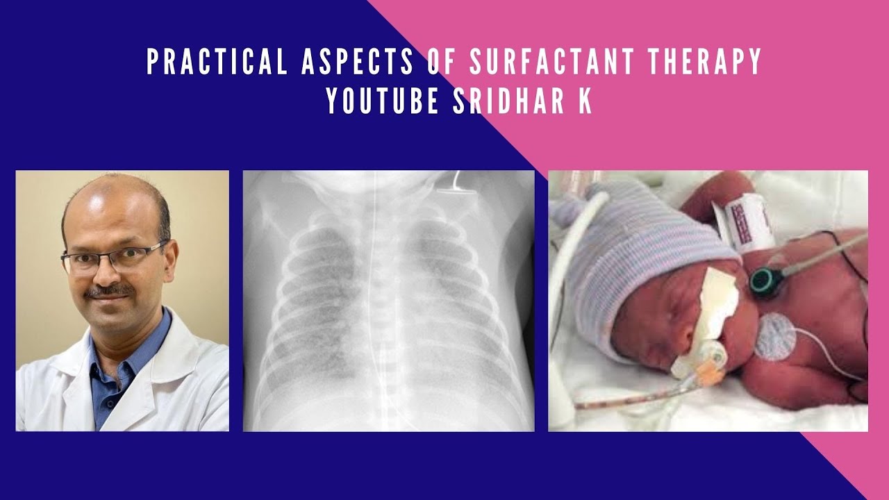 Practical aspects of surfactant therapy. A quick overview of how to ...