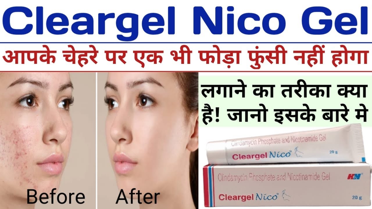 Cleargel nico uses | Cleargel nico for acne,pimple |फोड़े,फुंसी का सबसे ...