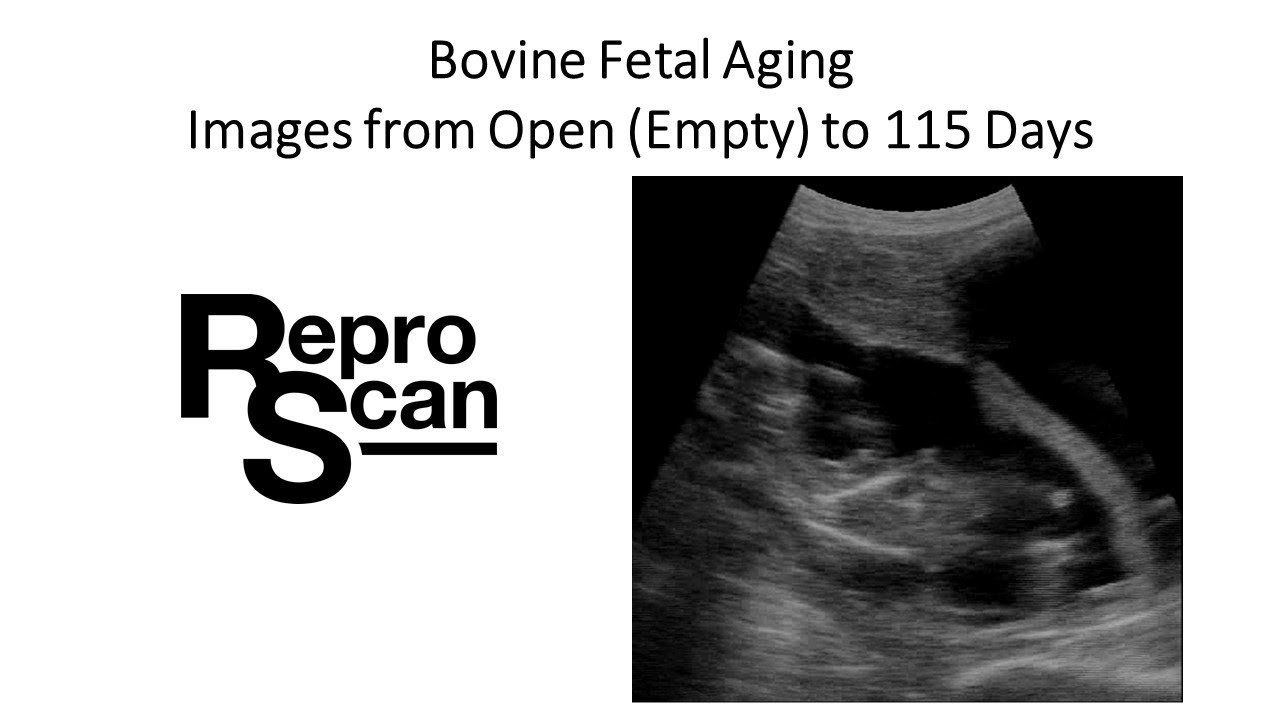 Repro-Scan Images 0 to 115 days 11132011 - YouTube