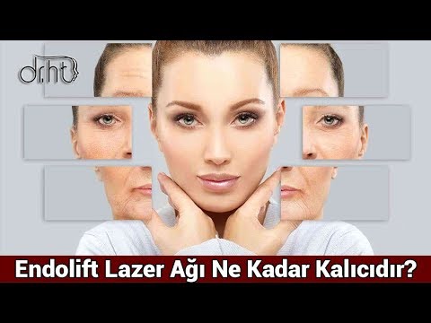 Endolift Lazer Ağı Ne Kadar Kalıcıdır?
