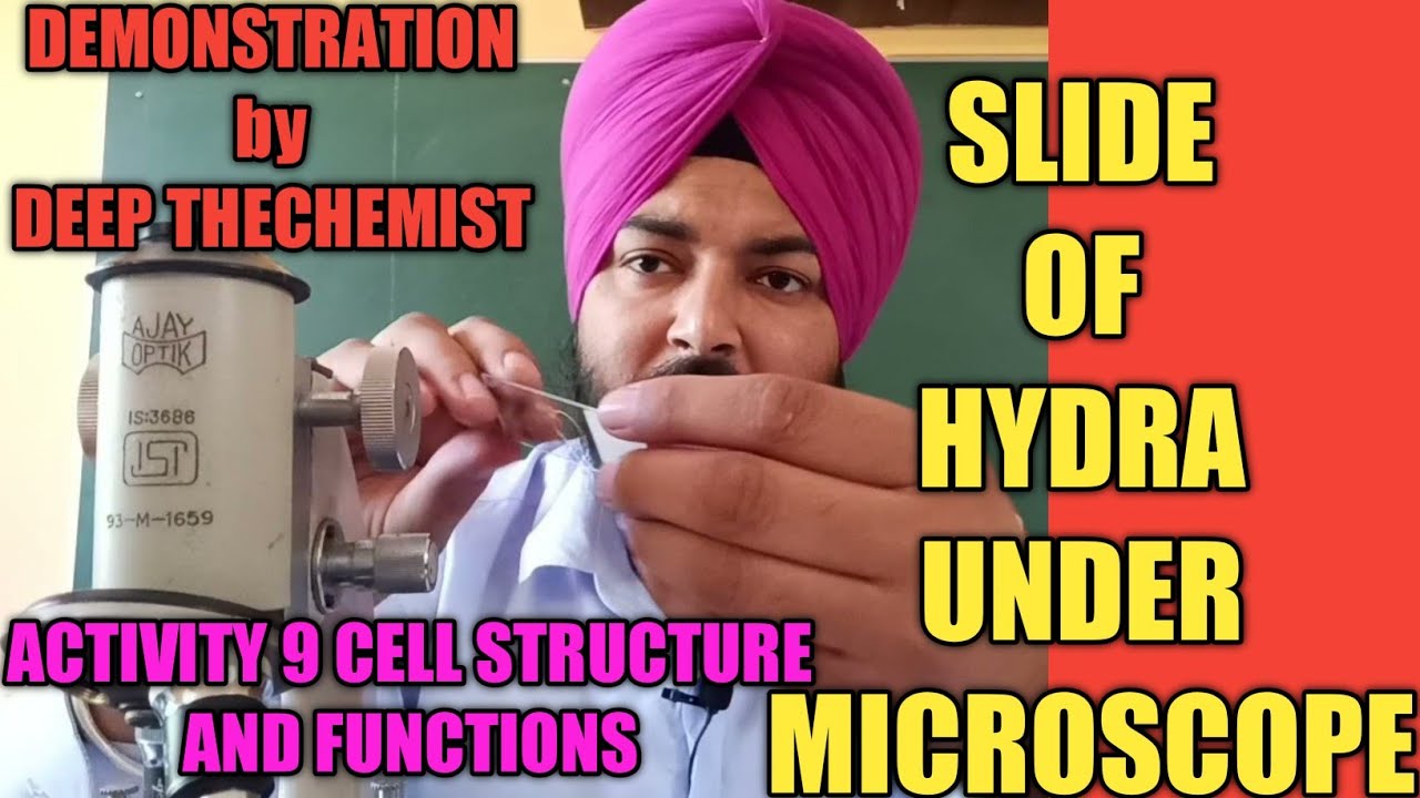 Slide of Hydra || Hydra under microscope | class 8 science - YouTube