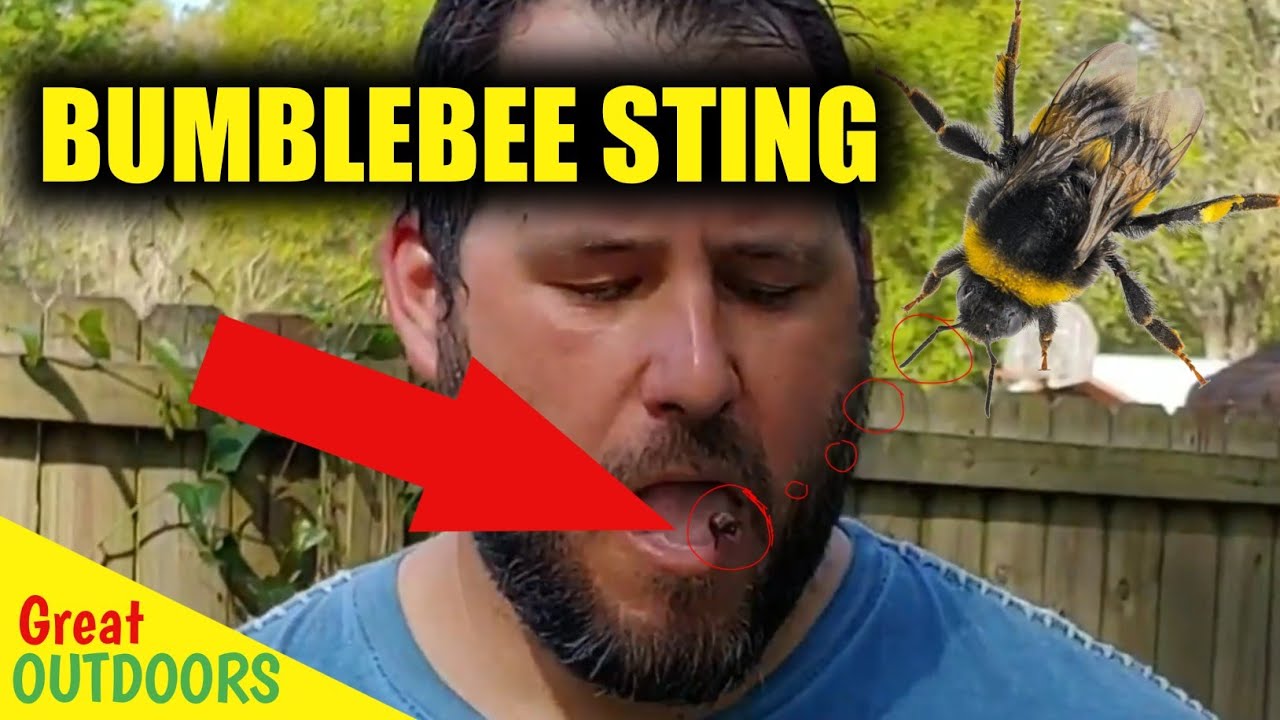 Bumblebee Insect Sting