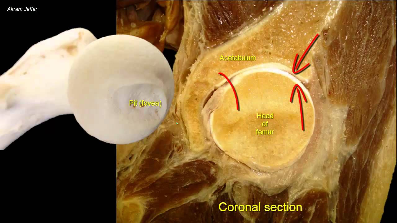 Femoral neck fracture - applied anatomy - YouTube