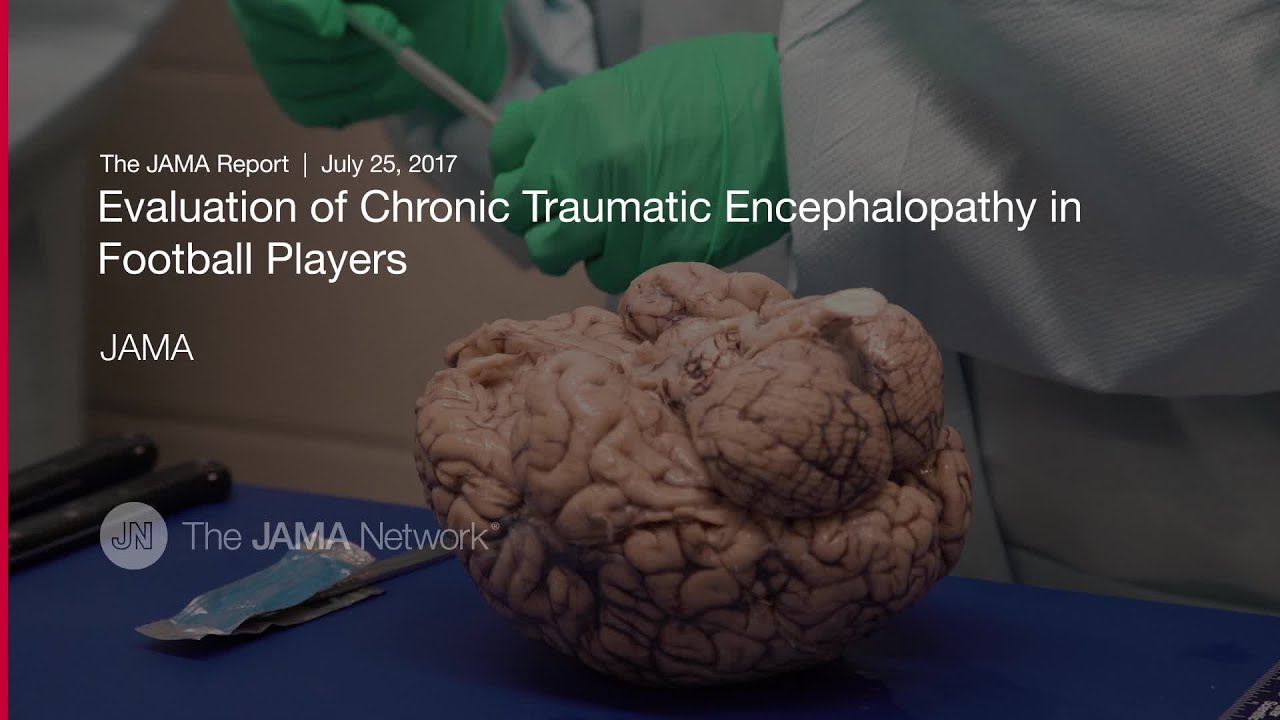 Which Chronic Traumatic Encephalopathy