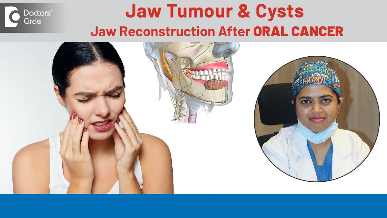 Cyst & Tumour in Tooth | Ameloblastoma & Jaw Reconstruction-Dr.Nishath ...