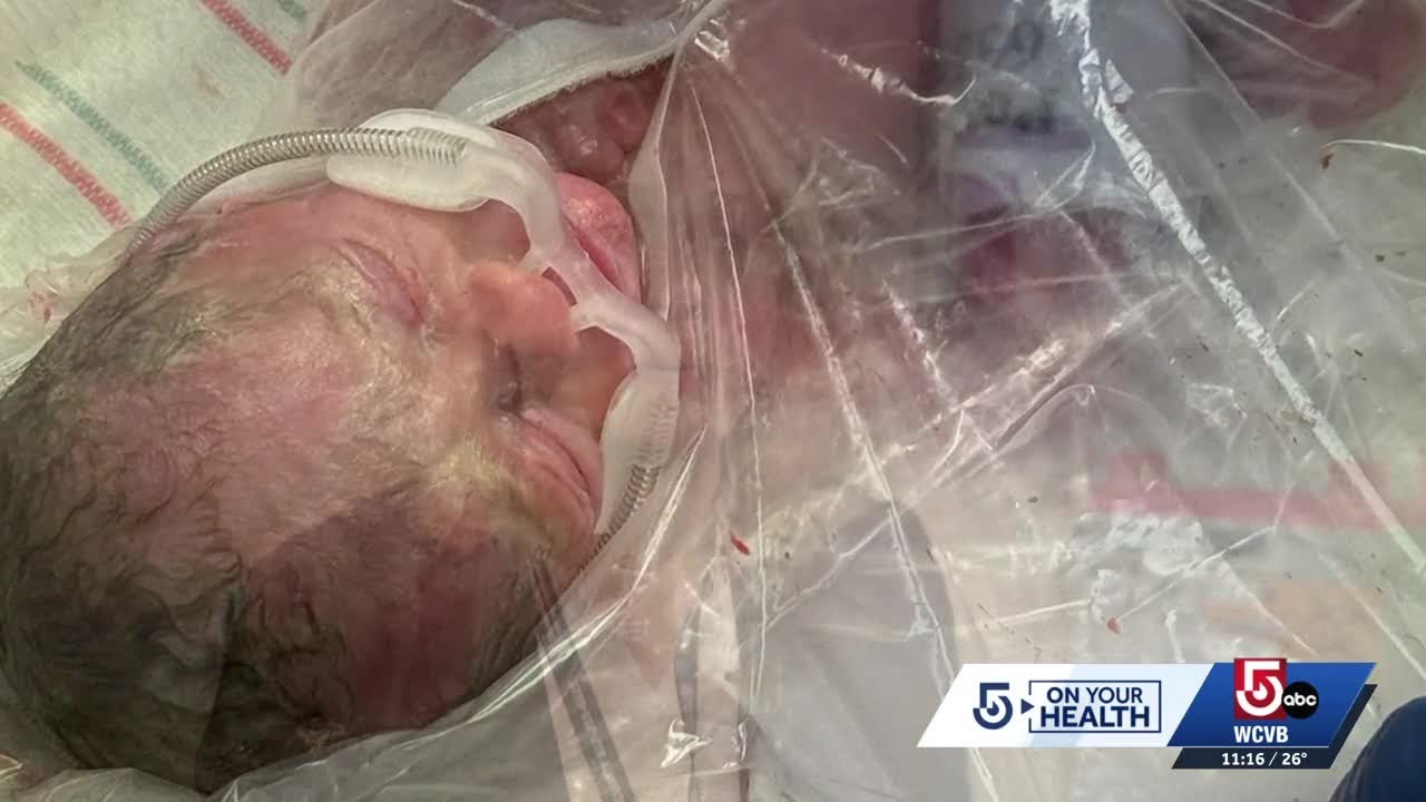 First New England baby born 'en caul' delivered at South Shore Hospital ...