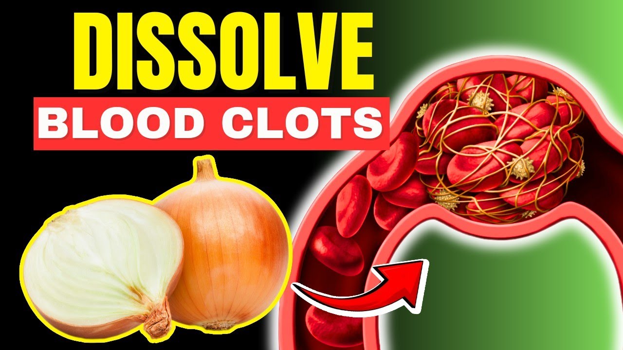 Top 8 Foods That Dissolve Blood Clots Naturally - YouTube