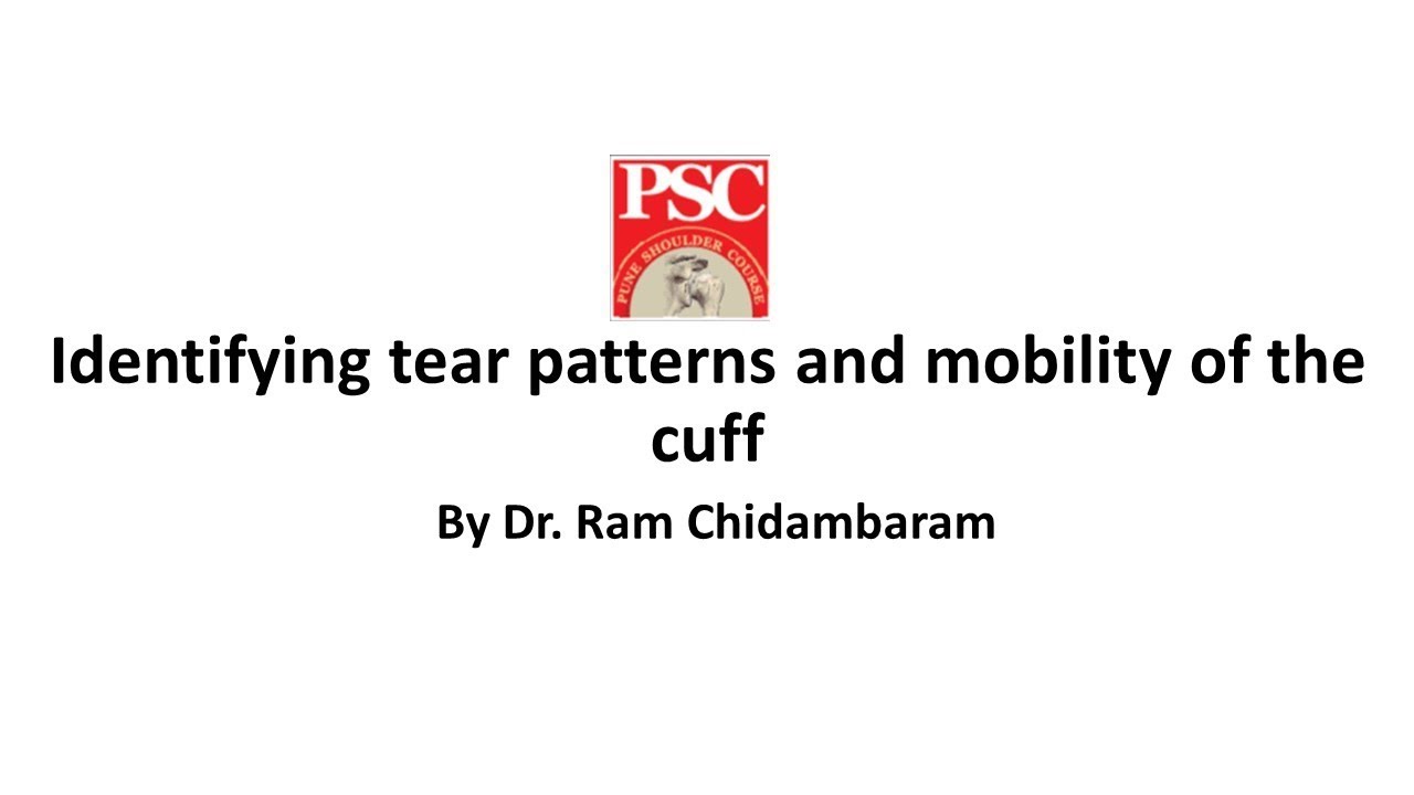 Identifying tear patterns and mobility of the cuff By Dr. Ram ...