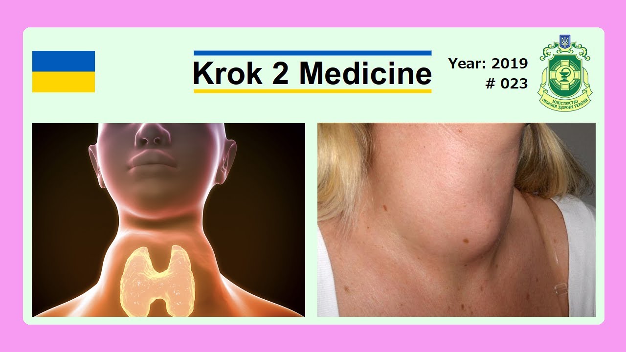 [ Krok 2 Medicine ] Year: 2019 - 023 (Ministry of Public Health of ...