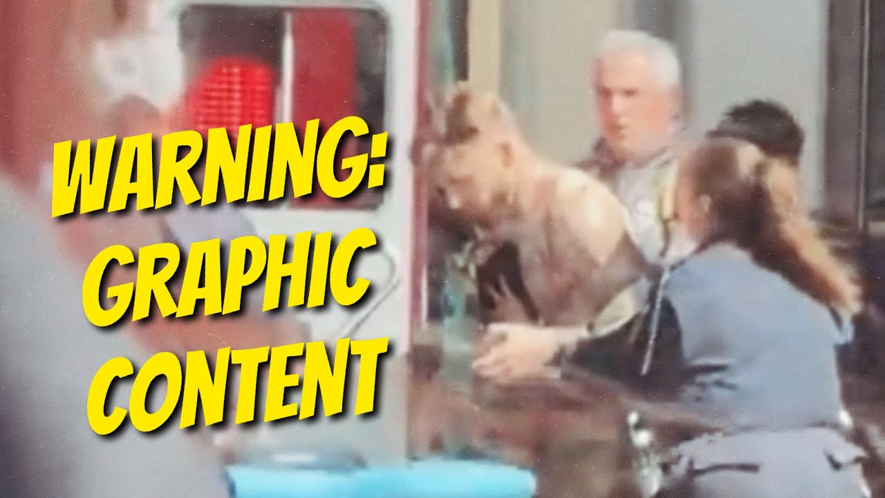 Graphic Warning: 49ers Ricky Pearsall seen with what appears to be ...