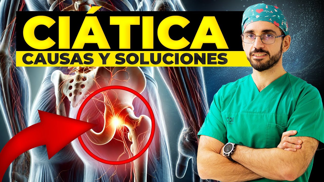 📌 TODO SOBRE LA CIÁTICA: CAUSAS, SÍNTOMAS Y TRATAMIENTOS 📌 - YouTube