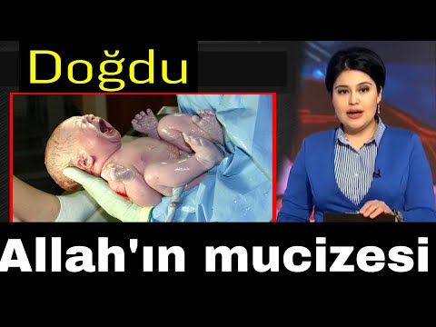 Allah'ın mucizesi doğdu