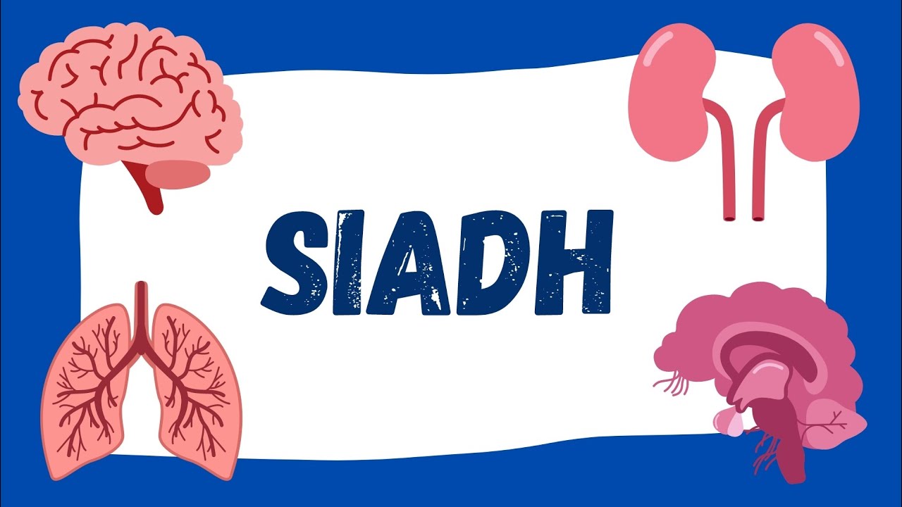 SIADH | Syndrome of Inappropriate ADH - Causes, Symptoms, Diagnosis ...