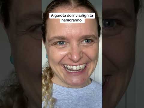 O q q rolou? #humor #invisalign