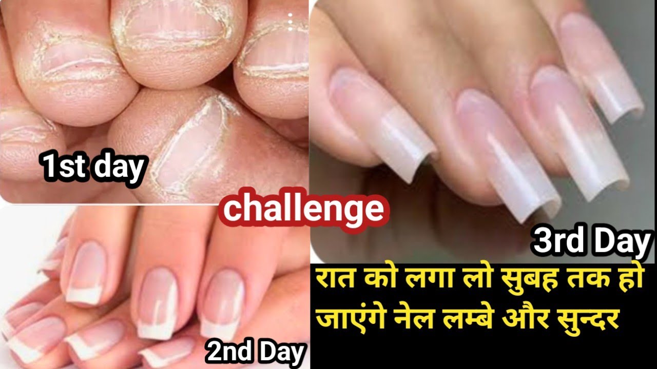 1 रात में नाखूनो को लम्बा और मजबूत और सुन्दर करने का रामबाण उपाय l Grow ...