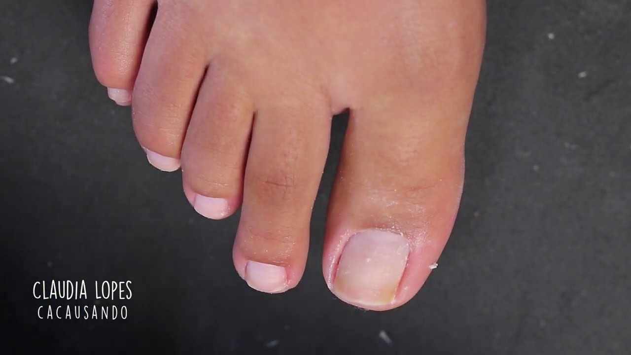ASSISTA: Cutilagem fina dos pés - YouTube