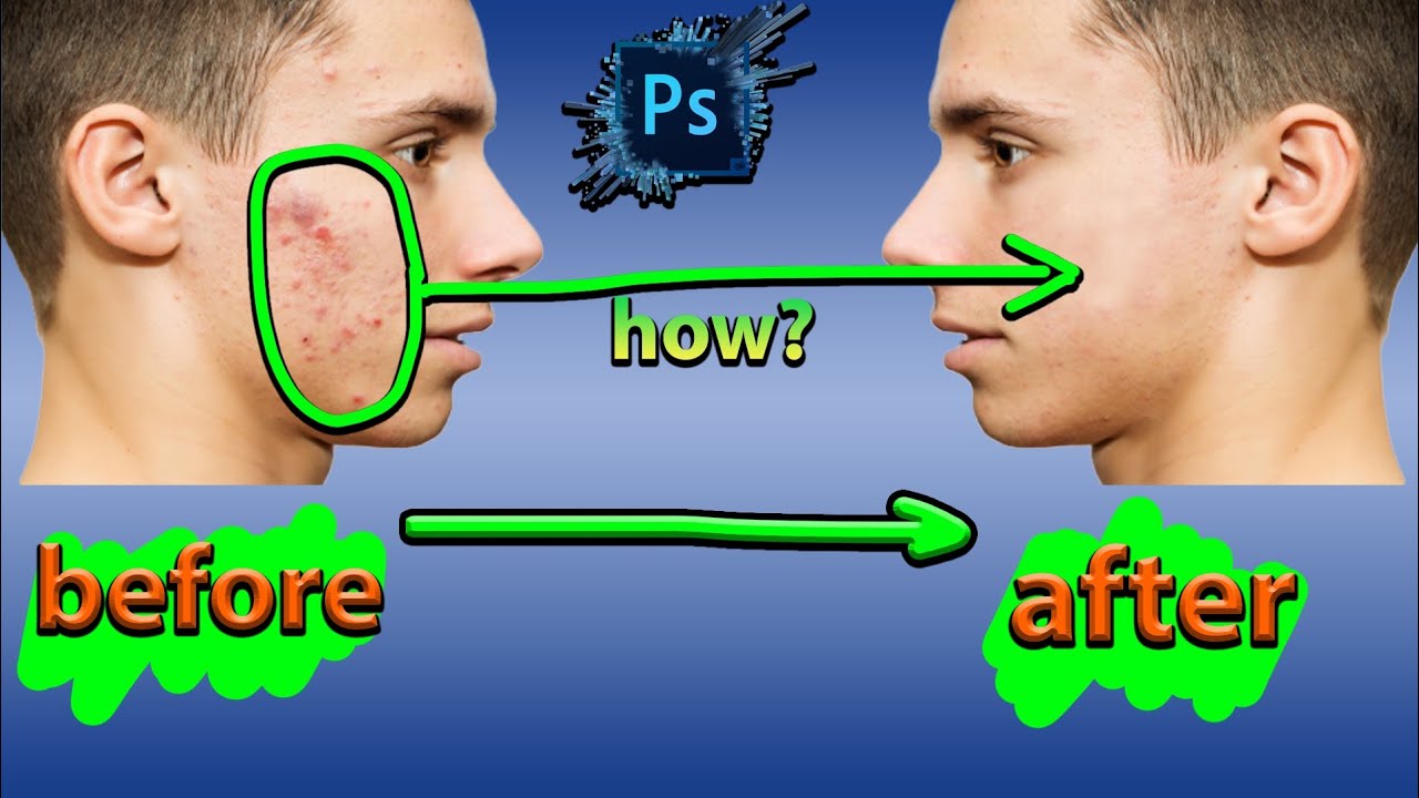 Get rid of acne on your face very quickly with Photoshop! #tutorial # ...