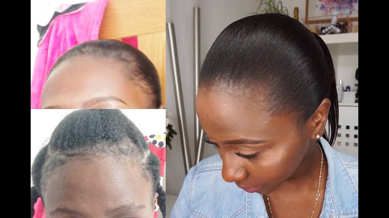 Get those edges back|My edges grew back in less than 10 days|The best ...