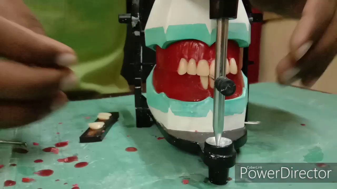 Promo of upcoming video mandibular anterior teeth setting - YouTube