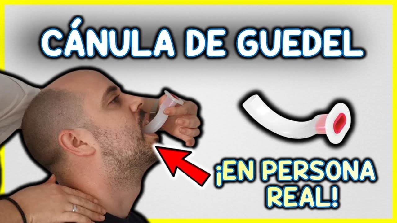 Cómo COLOCAR CÁNULA DE GUEDEL en una PERSONA REAL | Cánula orofaríngea ...