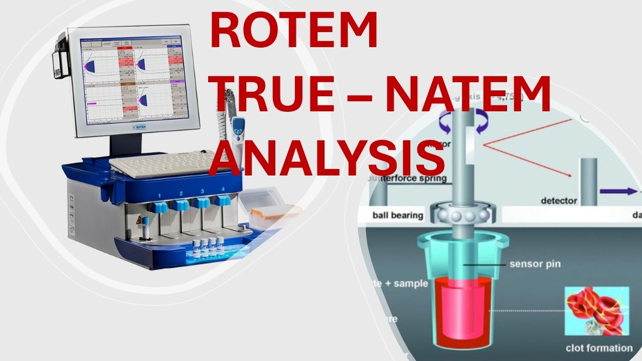 True NATEM analysis via Rotational Thromboelastometry (ROTEM ...