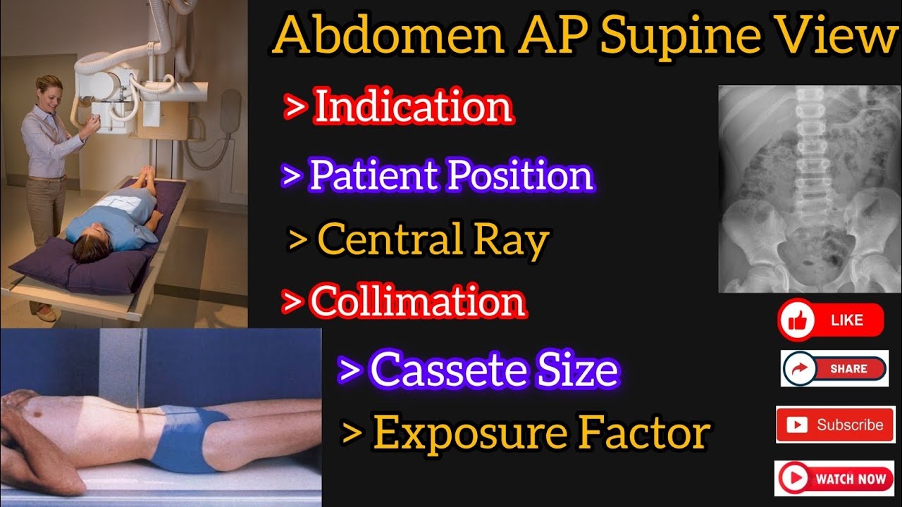 Abdomen AP Supine View Projection || Indication || Patient Position ||👈 ...
