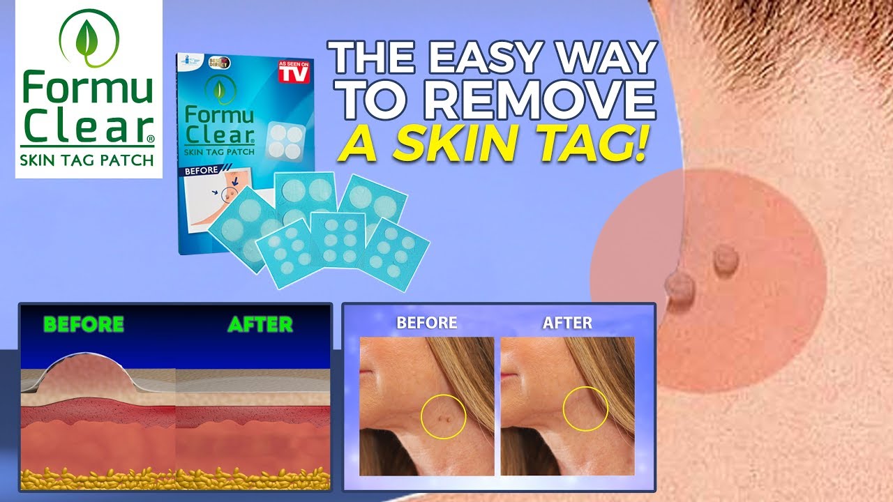 Formuclear Patch w/ BRE - YouTube