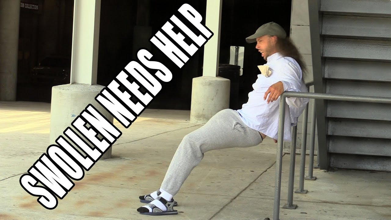 Swollen needs help! - YouTube