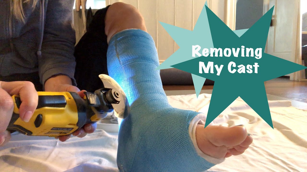 Cast Removal Practice on a Short Leg Walking Cast - YouTube