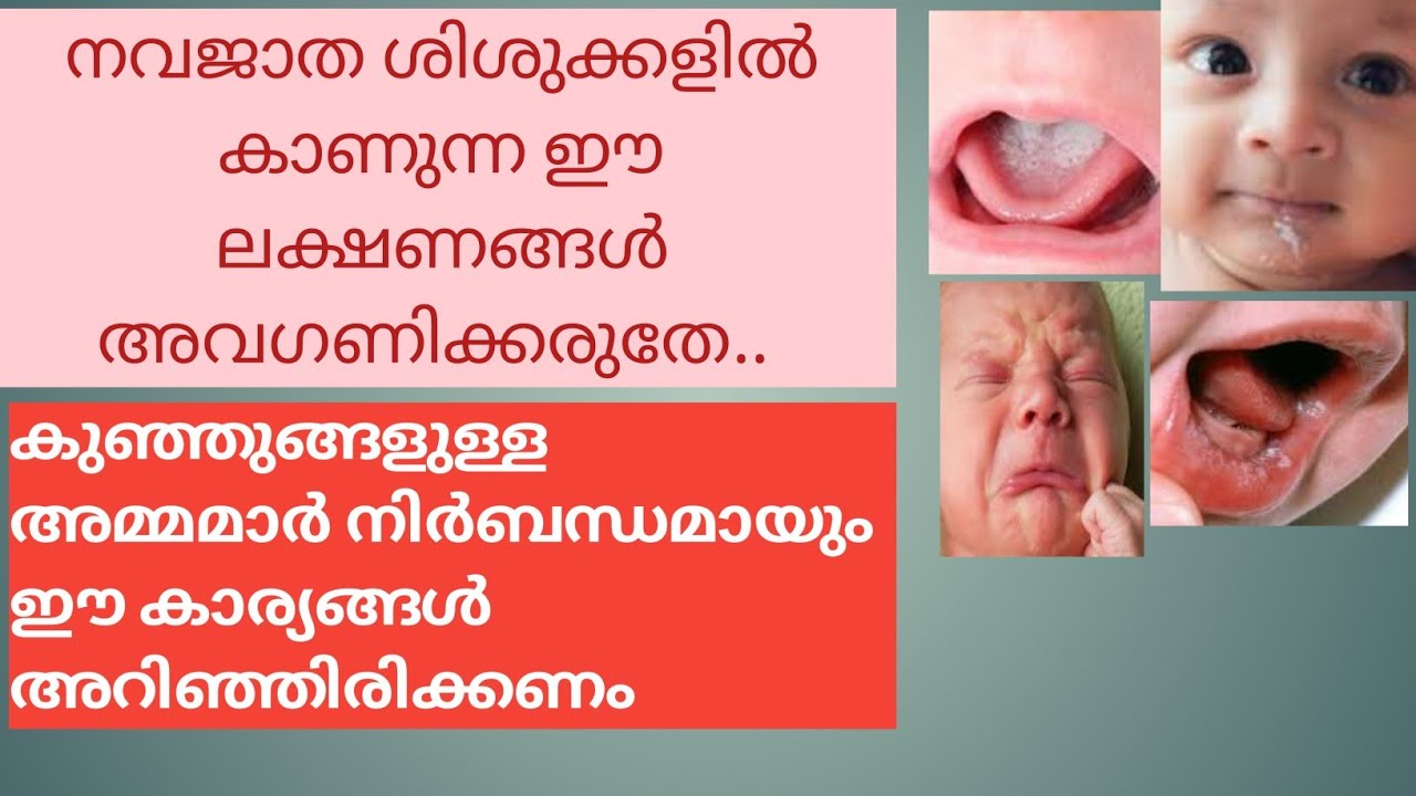 What are the normal and abnormal symptoms in newborn babies.. fency's ...