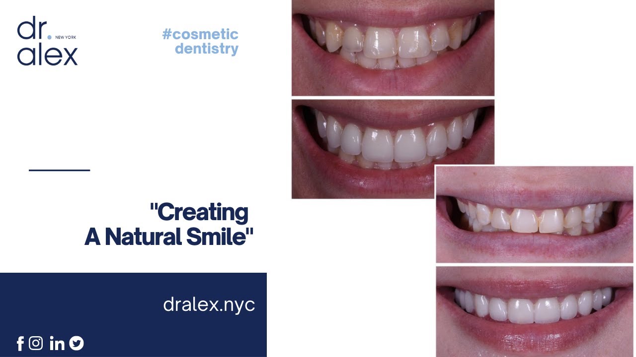 How I Create Smiles - Dr. Alex Rubinov - Cosmetic Dentist in NYC - YouTube
