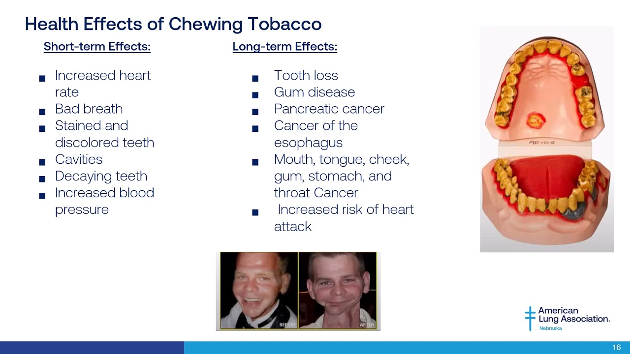 Effects Of Chewing Tobacco