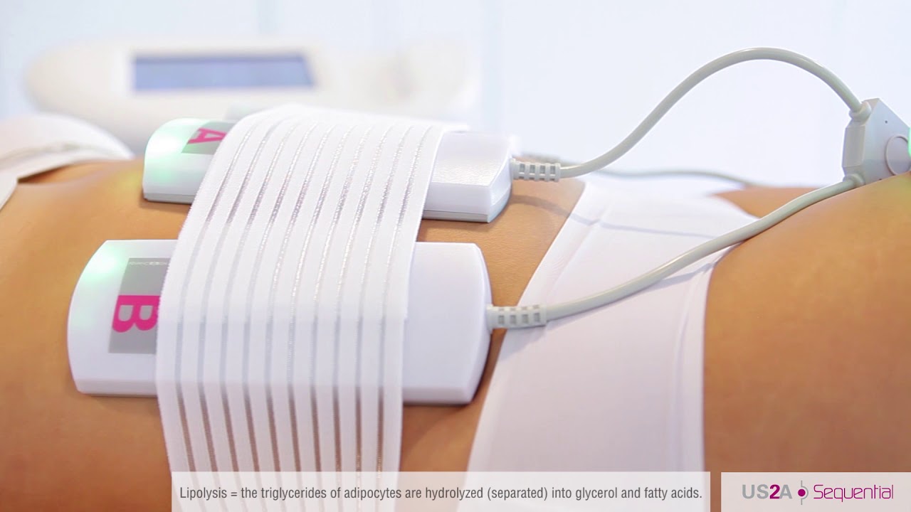 US2A for Slimming & Cellulite by Advance Derma Method - YouTube