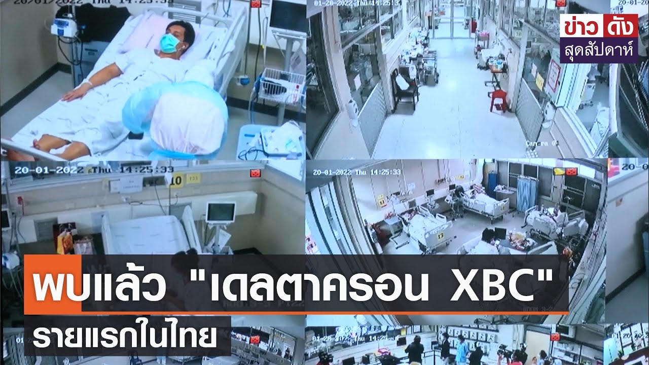 พบแล้ว "เดลตาครอน XBC" รายแรกในไทย | ข่าวดัง สุดสัปดาห์ 3-12-2565 - YouTube