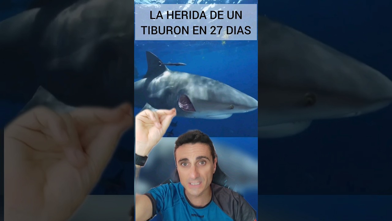 La herida del tiburón. #supervivencia #emergencia #curiosidades - YouTube