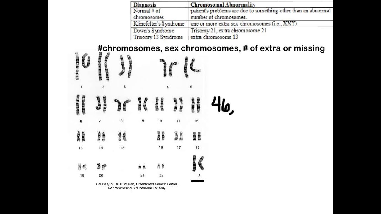 karyotype - YouTube