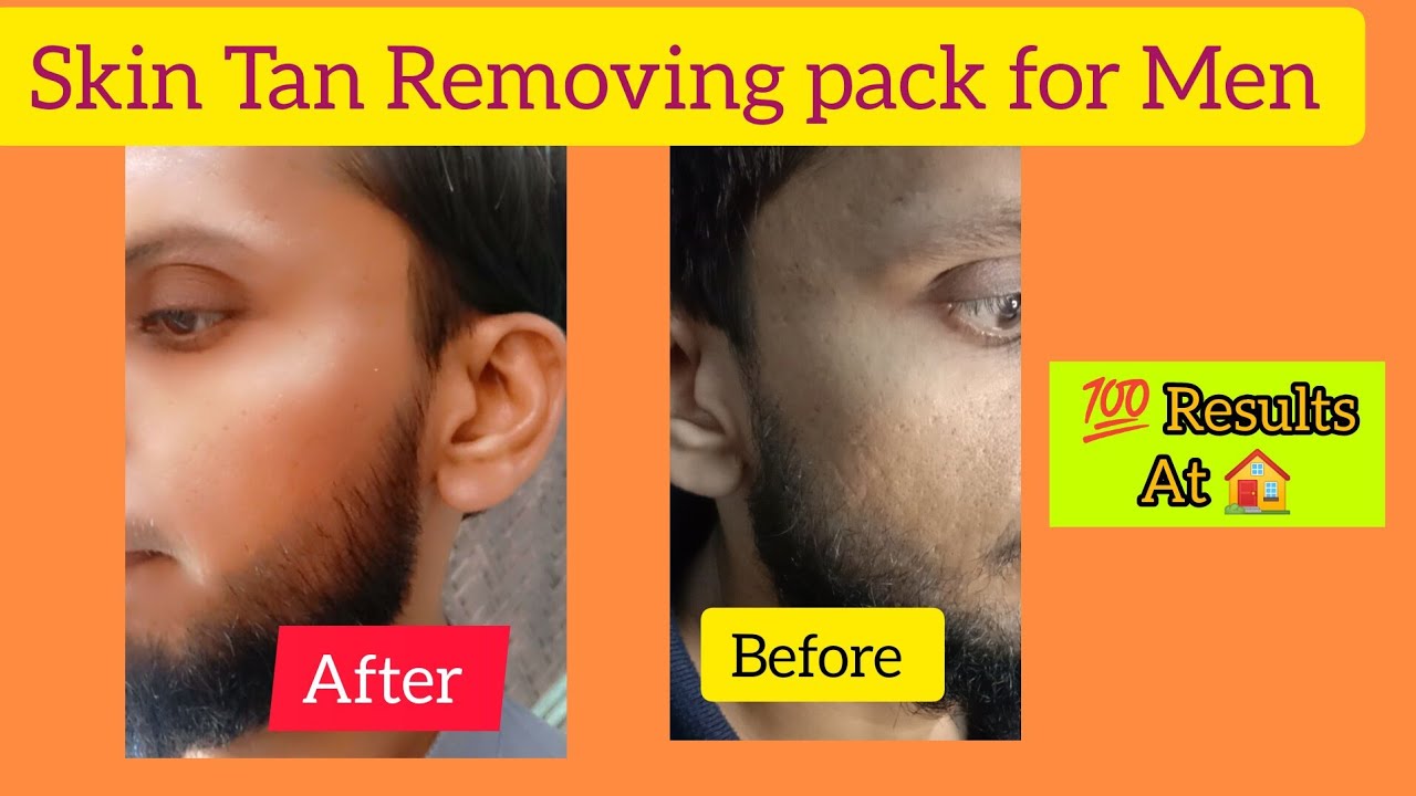 Most Effective Tan Removing Pack for men | D_Tan At Home in 15 mins ...