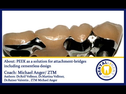 DENTALLIGENT Free full video - PEEK as a solution for attachment ...
