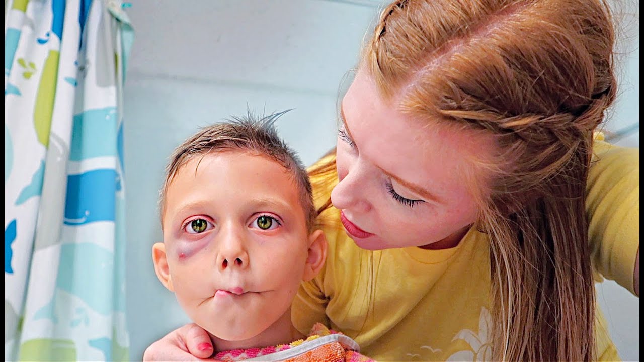 WHAT HAPPENED to your FACE... - YouTube