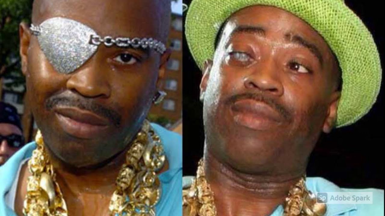 What s Really Wrong With Slick Rick's Eye? - YouTube
