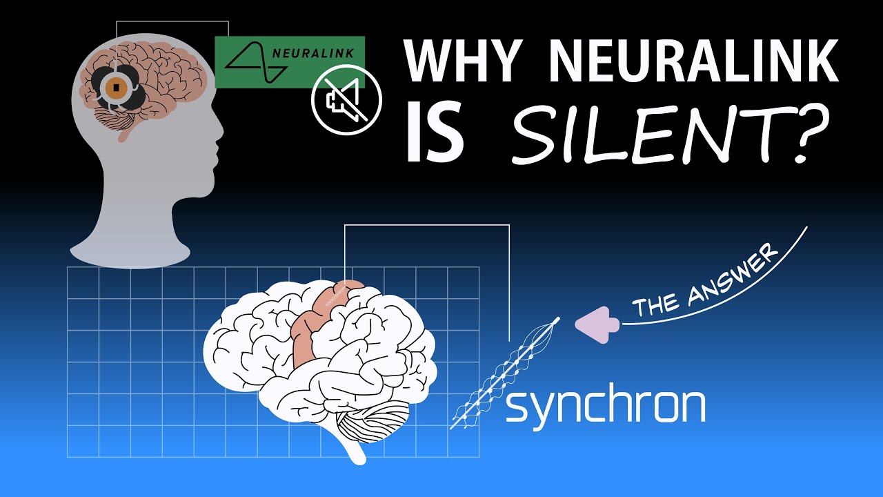 Neuralink Is Falling Behind… Synchron Is Leading the BCI Race - YouTube