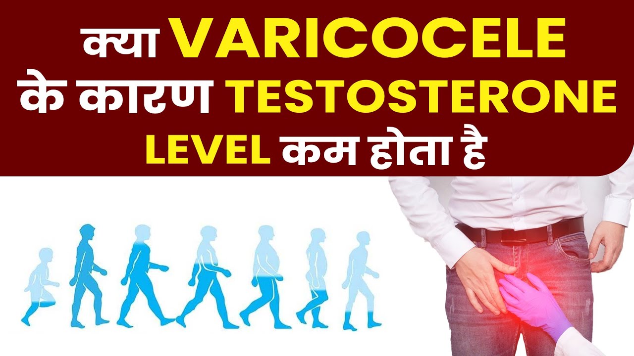 Kya Varicocele ki bimari se Testosterone Level kam ho jata hai ...