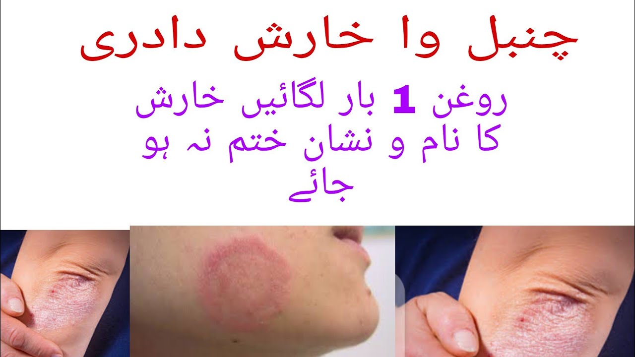 kharsh chambal wa kuch kho taar aisa Rogan1 born lagaen usi shifa ho ...