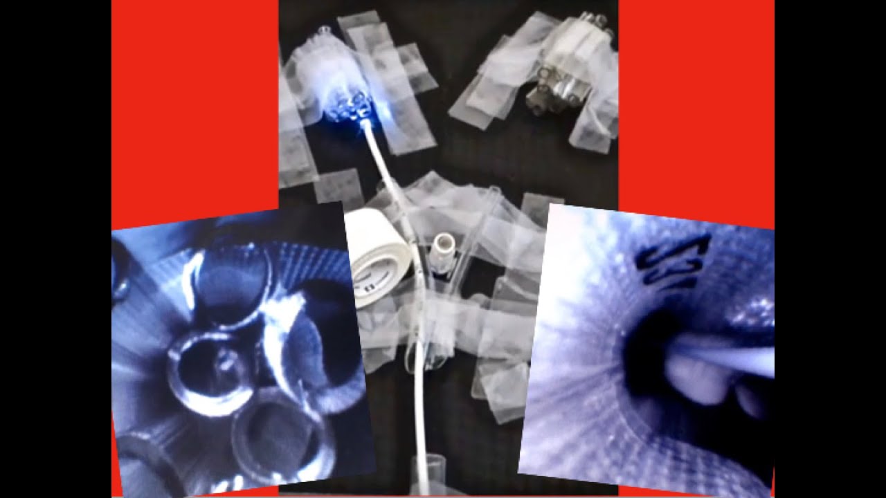 Learn how to do a fiberoptic intubation - YouTube