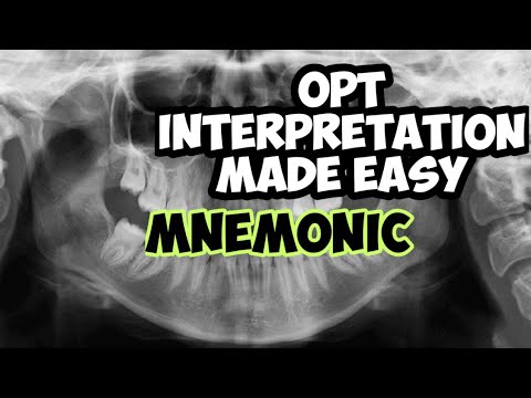 Dental Panoramic radiograph | OPT | DPT interpreting dental x-rays ...