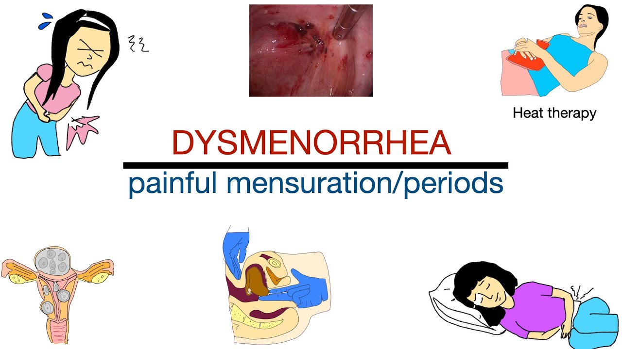Dysmenorrhea/Painful mensuration/Painful periods in women - YouTube