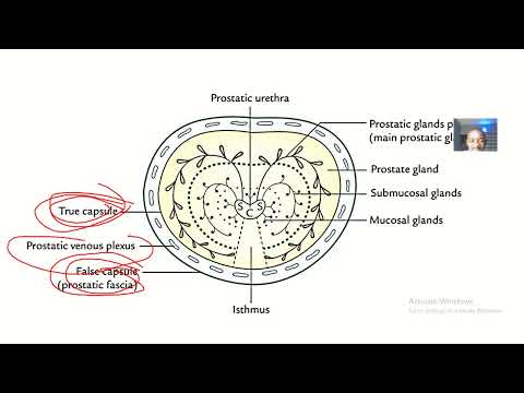 Capsules of the prostate gland; True, false and pathological prostate ...
