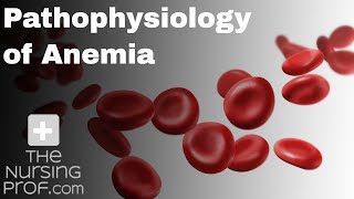 Pathophysiology of Iron Deficiency Anemia | Doovi