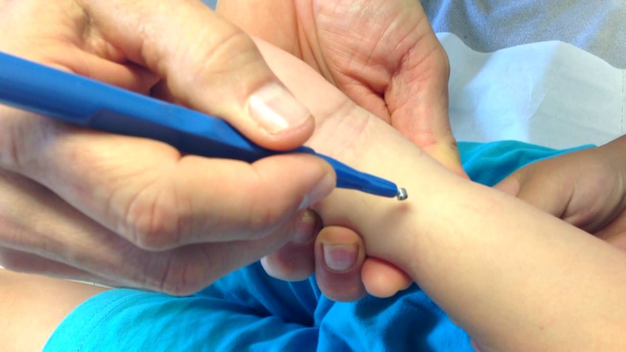 Molluskin Bambini DIMITRI DERMATOLOGY Updated February 2025 24