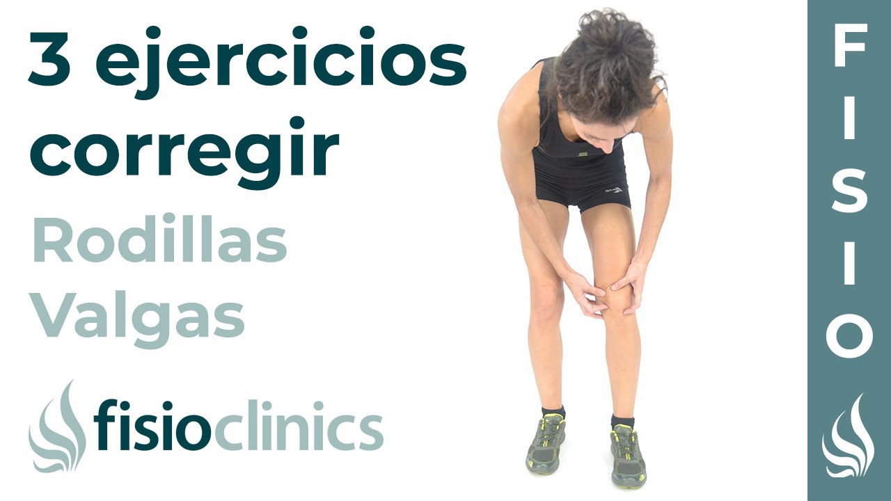 3 EJERCICIOS para corregir las RODILLAS VALGAS o Rodillas en X ...